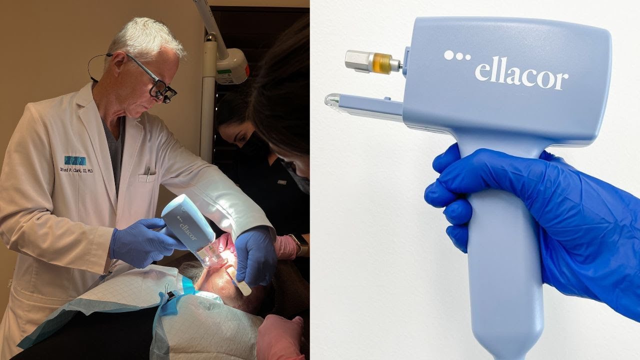 Ellacor : Micro-Coring Treatment - YouTube