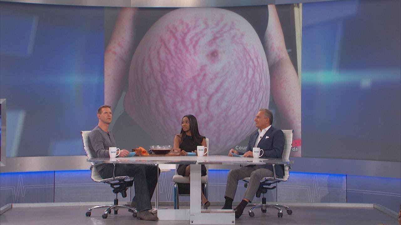 What Caused This Woman’s Inflamed Belly? - YouTube