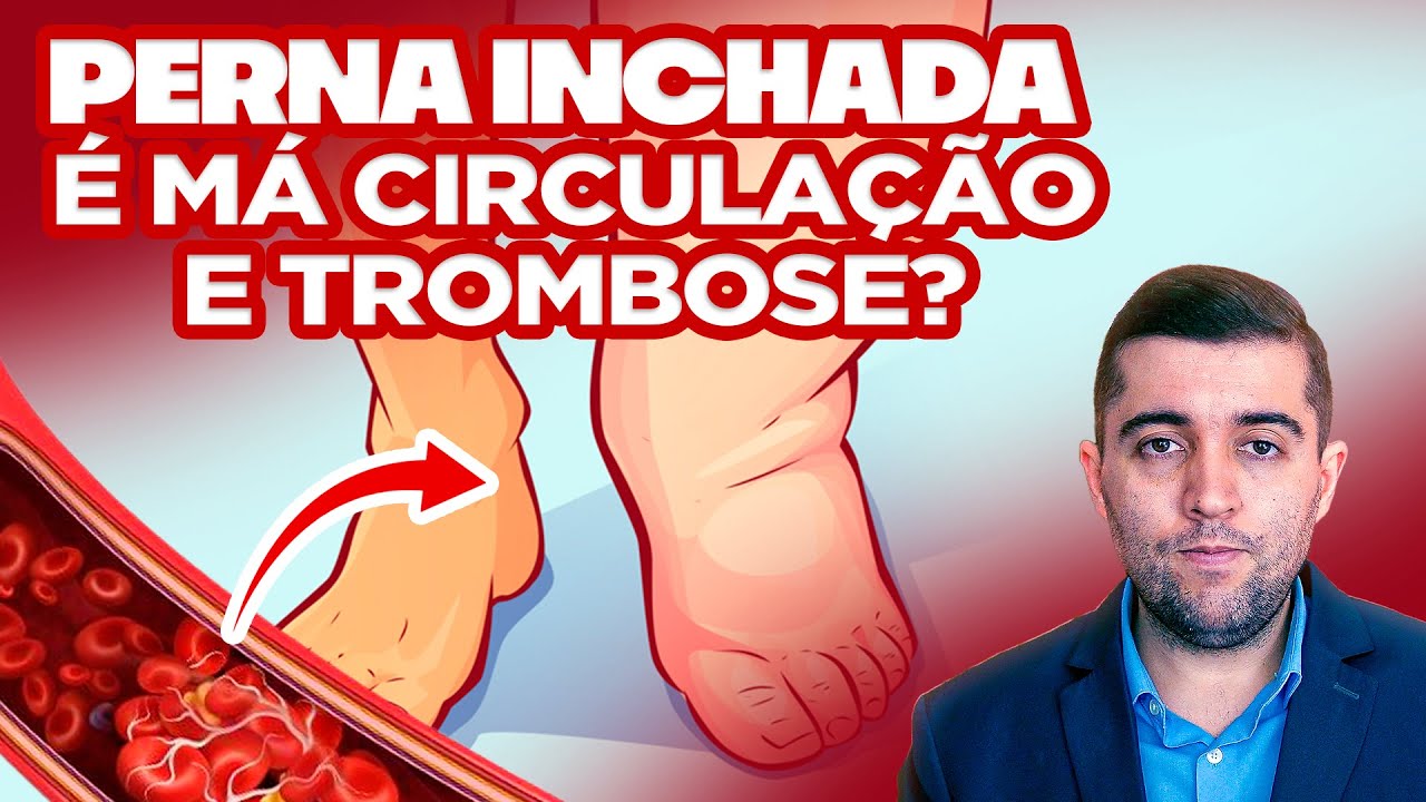 Perna inchada: como resolver a má circulação e trombose? Qual risco de ...
