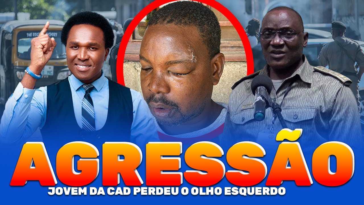 Jovem Da CAD Foi Agredido Ate Perder O Olho Por Se Aliar Aos Que Apoiam ...