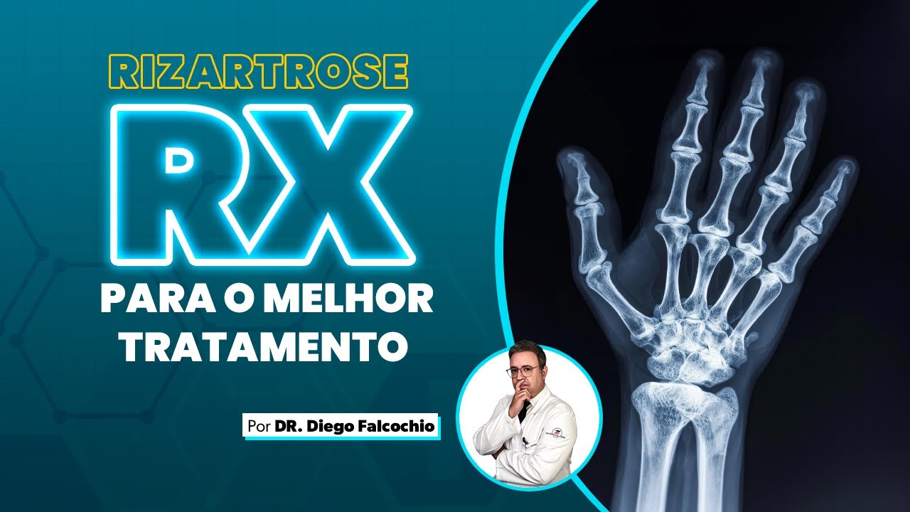 Rizartrose Avaliação Radiográfica para o melhor tratamento | Série ...