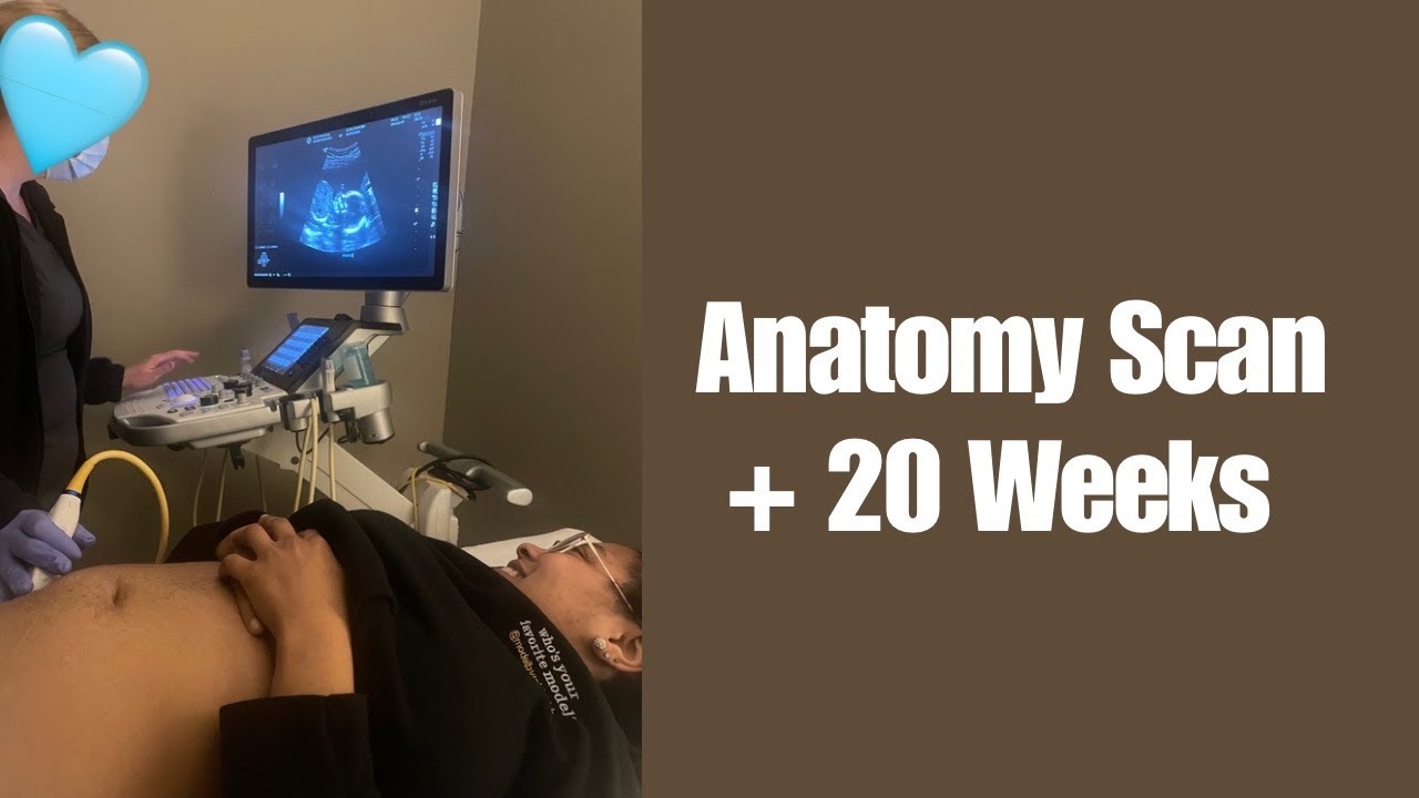 Anatomy Scan + 20 Weeks | Pregnancy Vlog 9 - YouTube