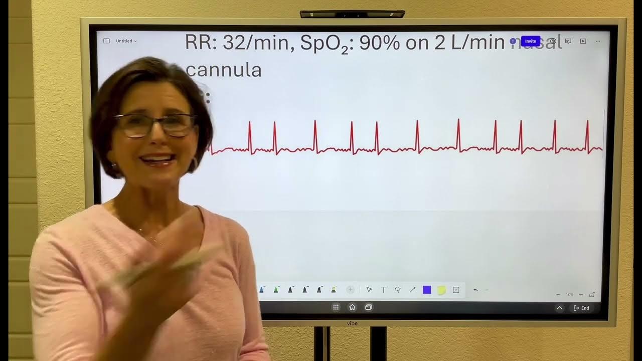 Atrial Fibrillation & Sync Cardioversion - YouTube