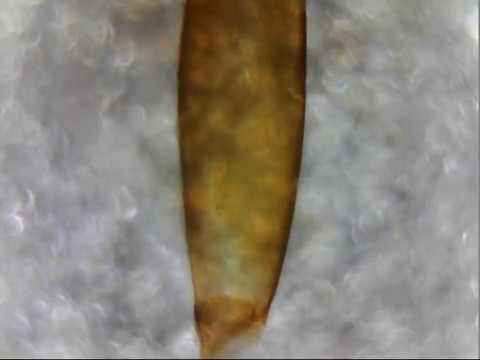 Butterfly leg under a microscope - YouTube