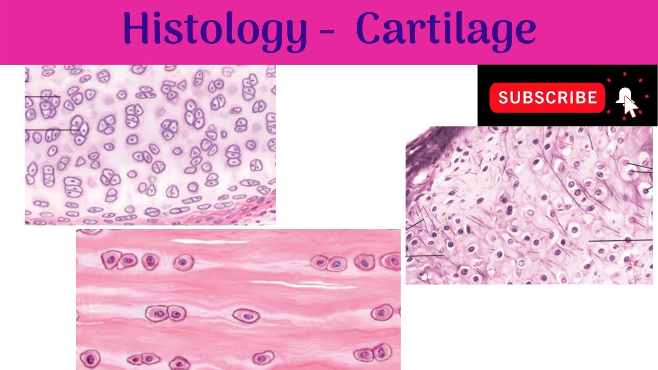 Histology Of Cartilage | Components | Types | Features | Pathological ...