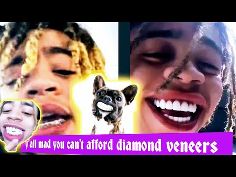 King Harris new big teeth 100,000 for veneers t.i and tiny clap back ...