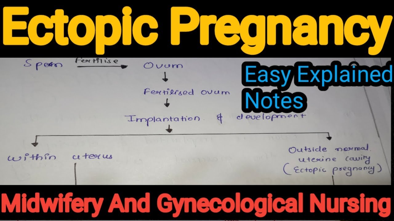 Notes Of Ectopic Pregnancy in Midwifery And Gynecological Nursing in ...