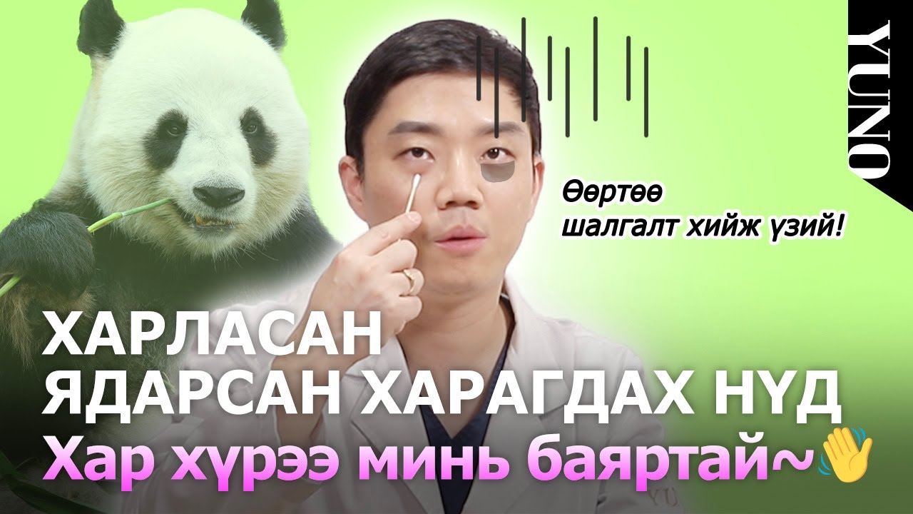 Ингэж хийвэл хар хүрээ алга болох уу Өөртөө шалгалт хийж үзий Youtube