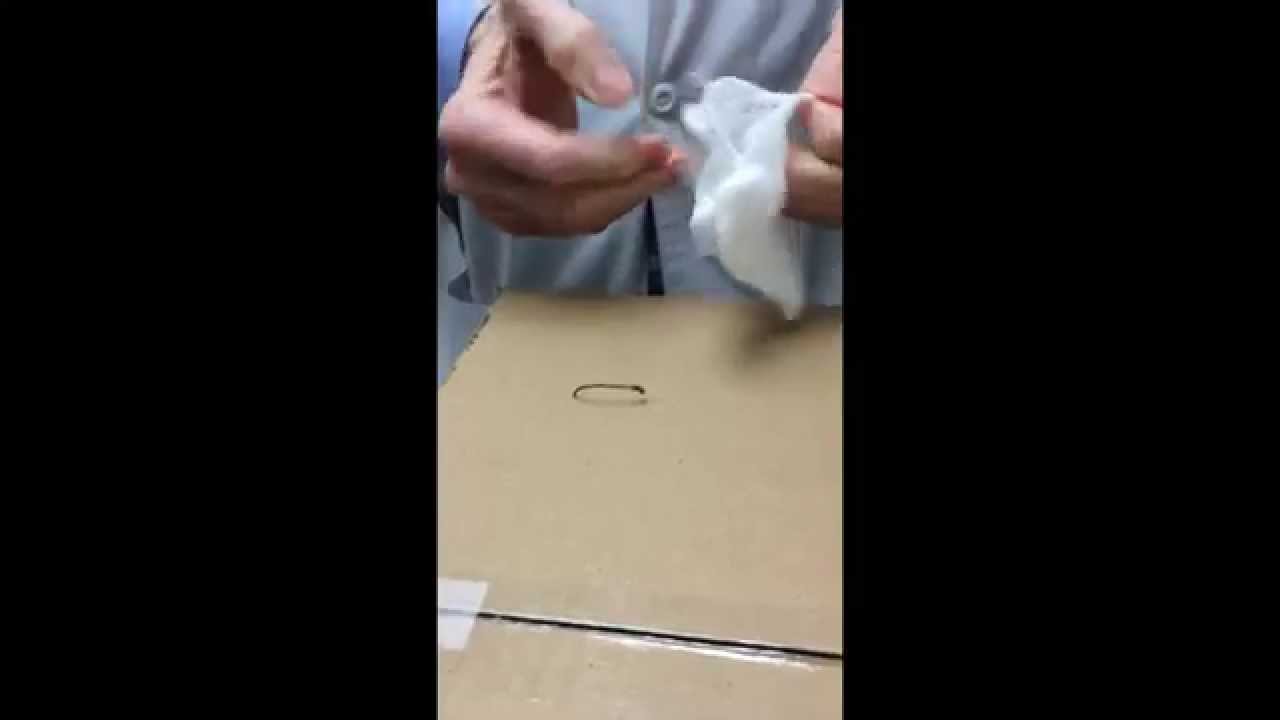 Fishhook Removal Technique - YouTube