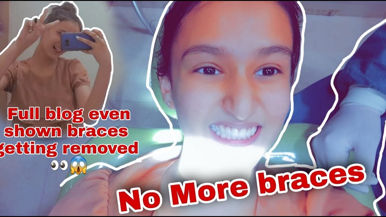Finally getting my braces off! - YouTube