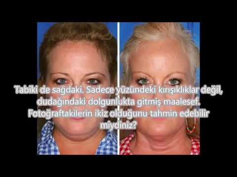 Sigara İçen ve İçmeyen İkizler Arasındaki Belirgin Farklar