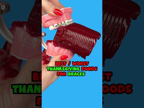 6 BEST and WORST Thanksgiving DINNER foods for braces 👀 #braces #dinner #asmrfood