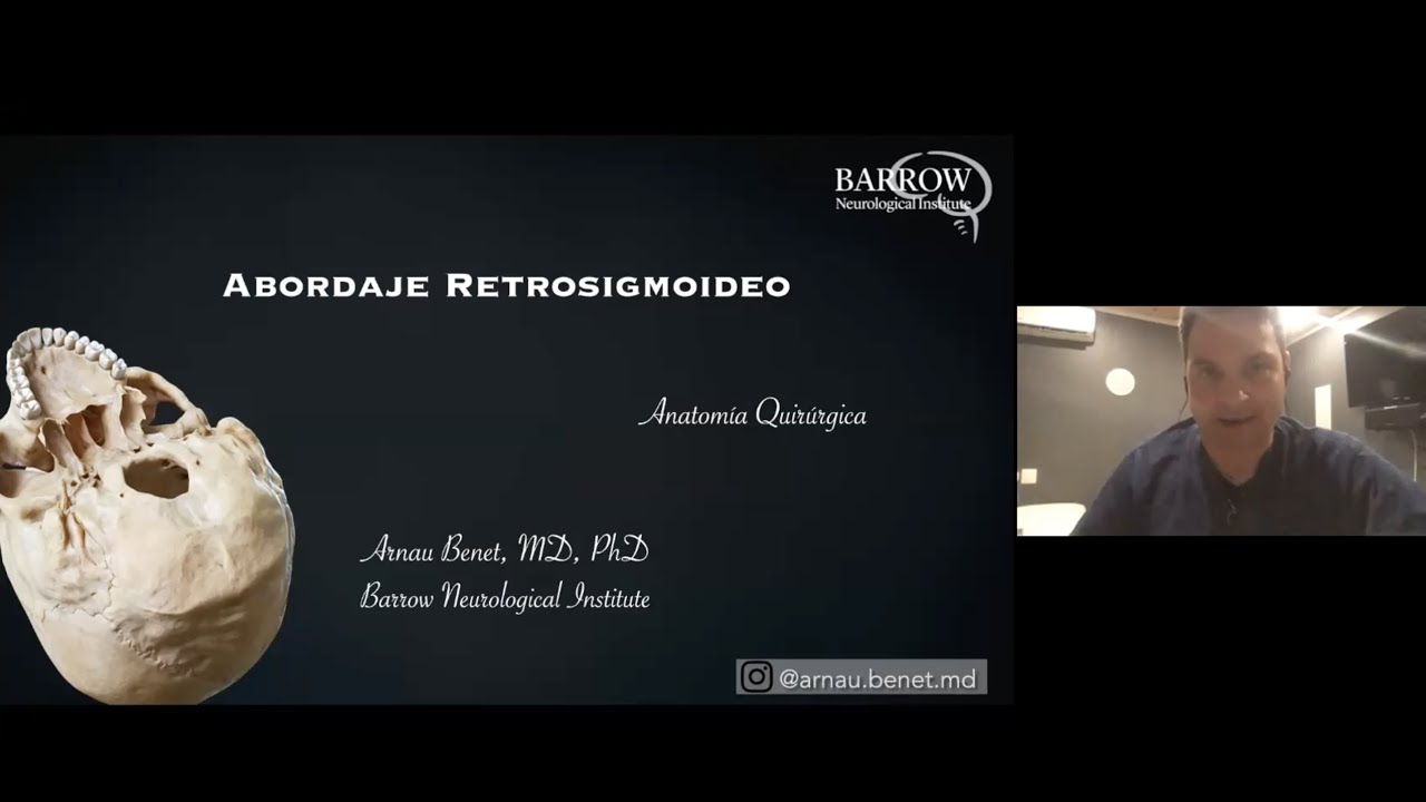 WEBINAR COMITE NEUROCIRUJANO JOVEN. DR ARNAU BENET: ABORDAJE ...