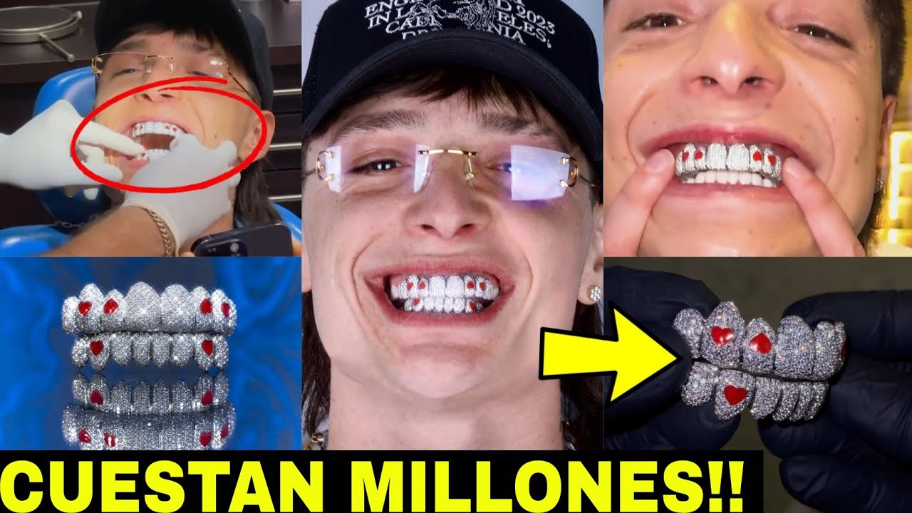 Peso Pluma PRESUME SU LUJOSA Y EXTRAVAGANTE prótesis de dientes con ...
