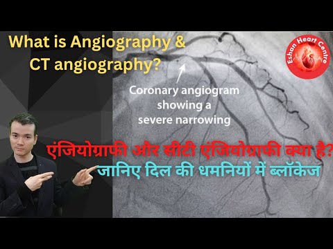 Angiography test kya hai, kaise hoti hai. Angiography vs CT Angiography ...