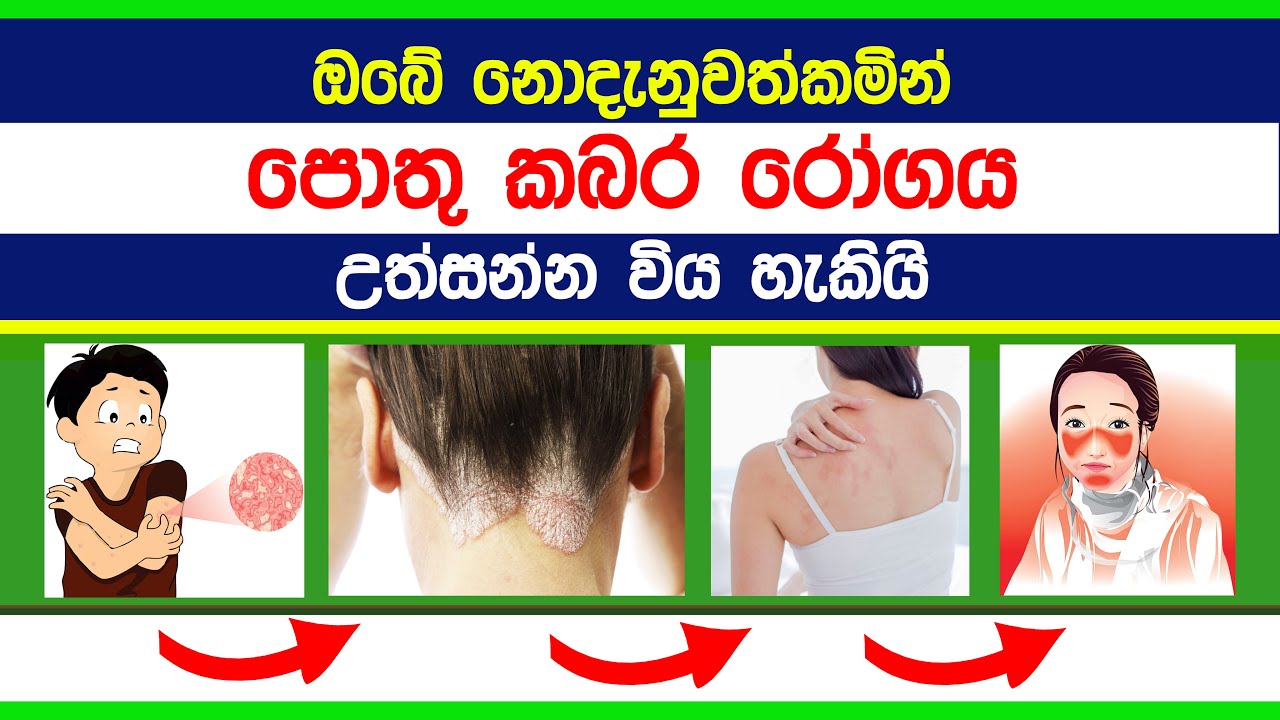 In Your Ignorance Bark Disease Can Worsen in-your-ignorance-bark-disease-can-worsen