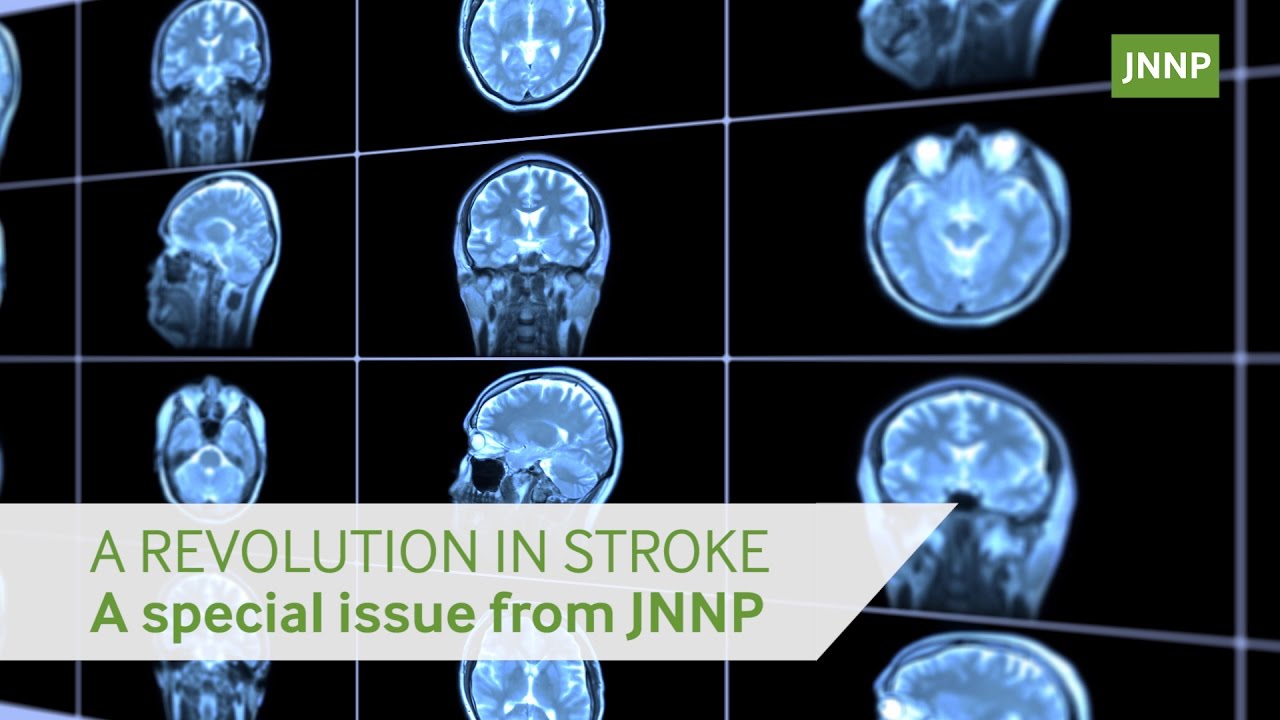 A Revolution in Stroke: JNNP special issue - YouTube