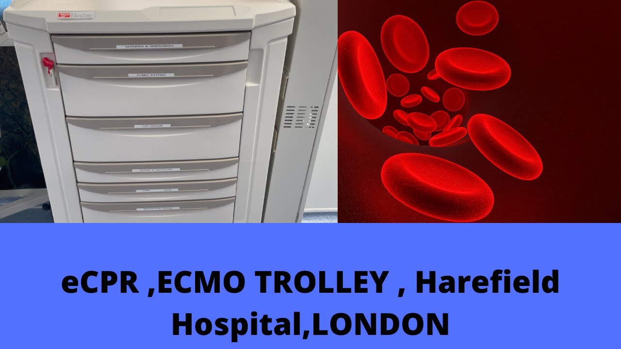 eCPR ,ECMO Trolley, Harefield Hospital, LONDON - YouTube