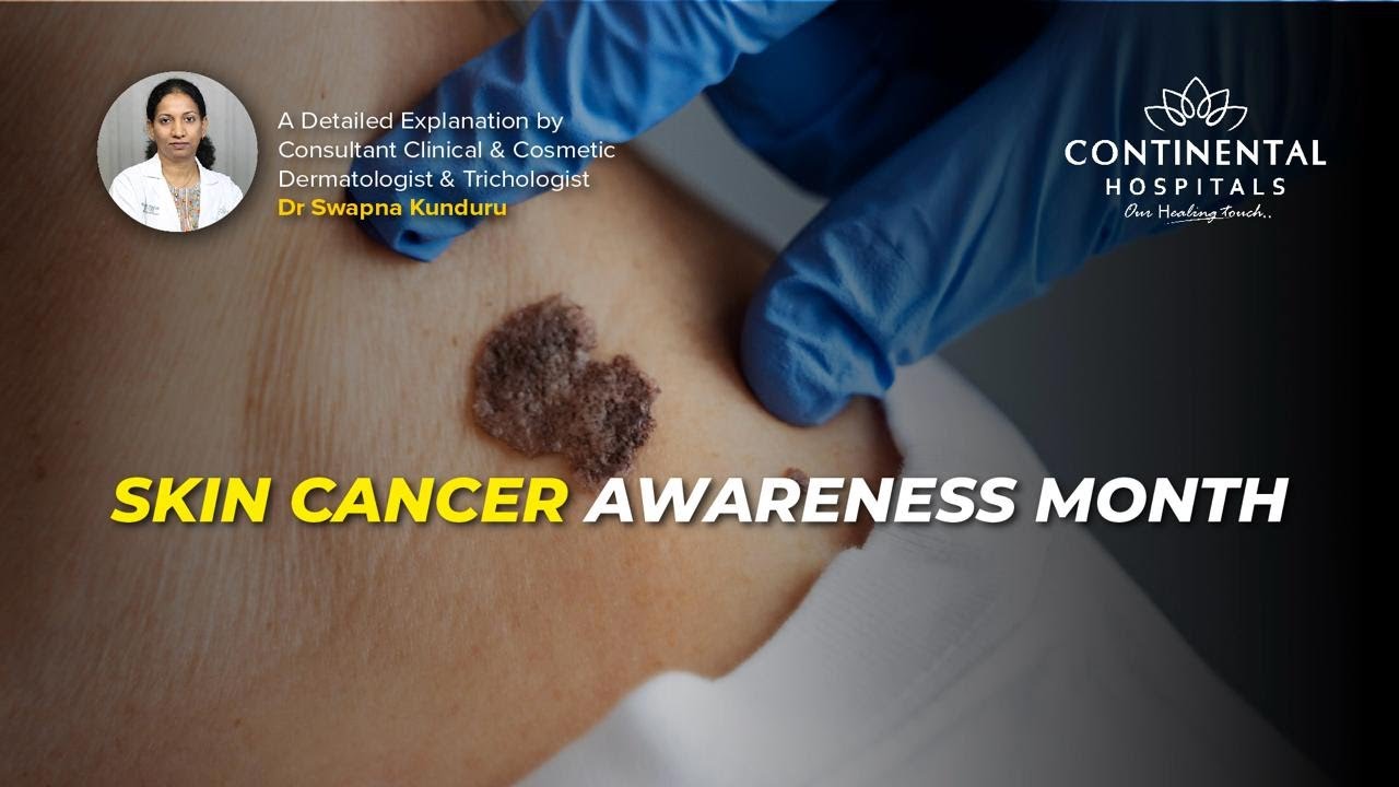Skin Cancer Treatment, Causes, Symptoms - Dr. Swapna, Cosmetic ...