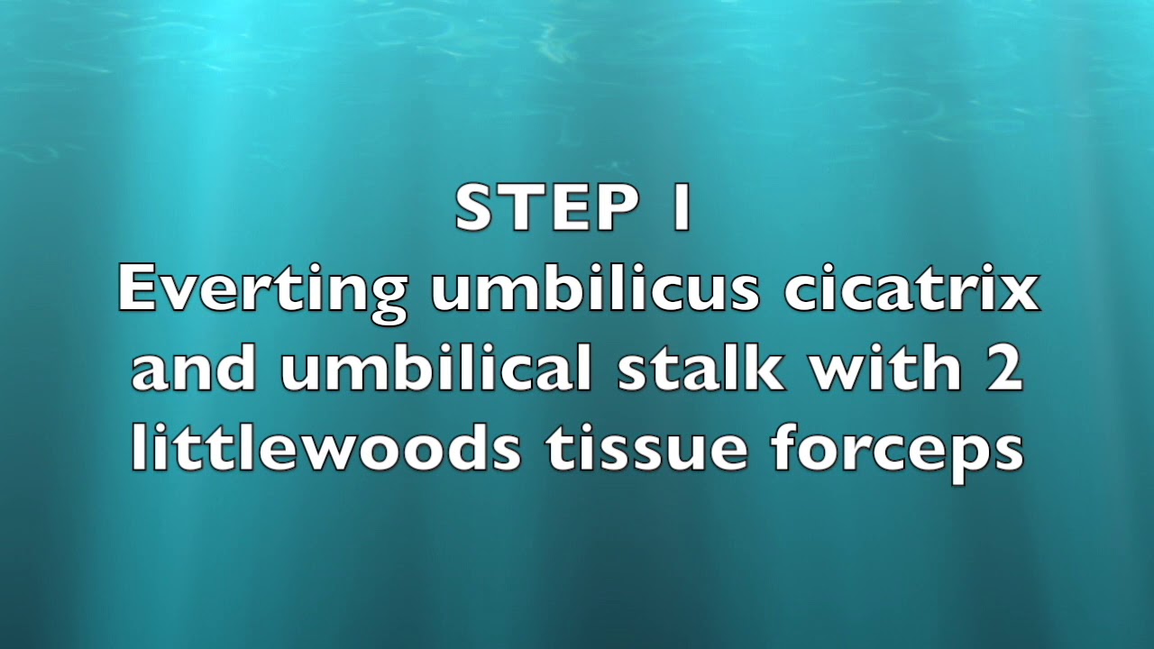 VIDEO 10: Open umbilical entry with umbilical stalk elevation technique ...