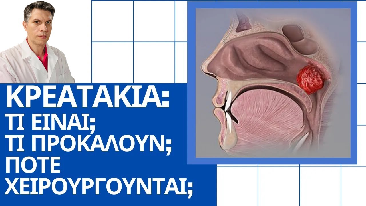 Πότε πρέπει να γίνει ΧΕΙΡΟΥΡΓΕΙΟ στα ΚΡΕΑΤΑΚΙΑ (ΑΔΕΝΟΤΟΜΗ) ; - YouTube