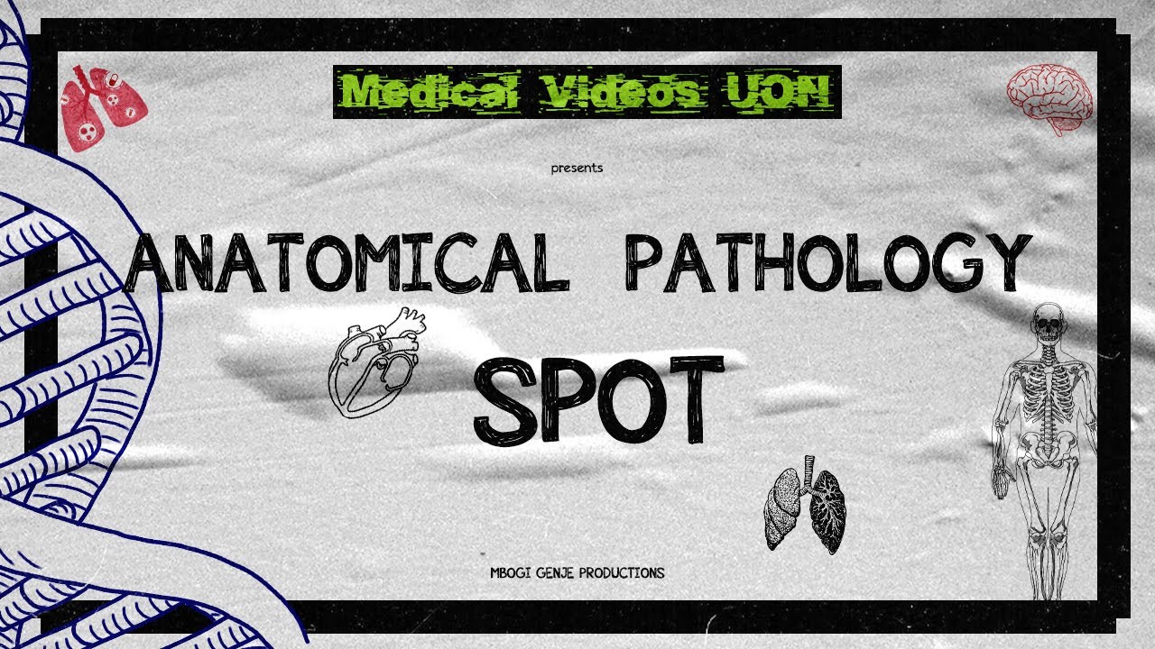 ANATOMICAL PATHOLOGY : HEART PATHOLOGY REVISION - YouTube