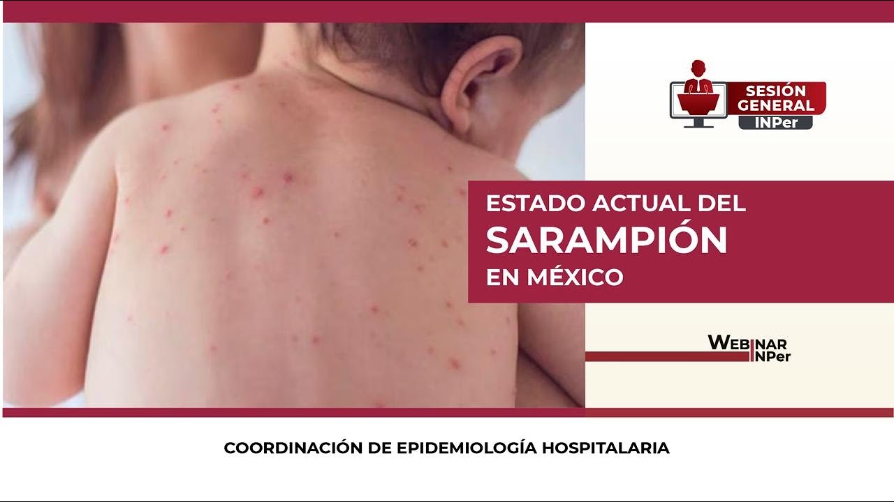ESTADO ACTUAL DEL SARAMPIÓN EN LA CIUDAD DE MÉXICO 2024 - YouTube