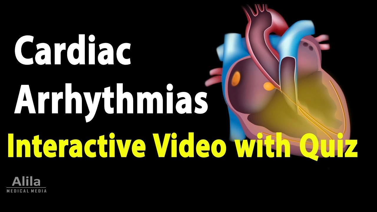 NEW: INTERACTIVE Video with Quiz: Cardiac Arrhythmias - YouTube