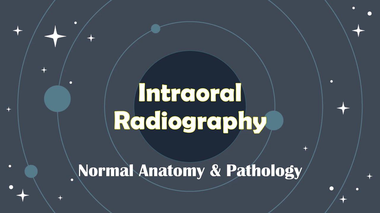 Intraoral Dental Radiography (Guess the Normal Anatomy & Pathology) # ...