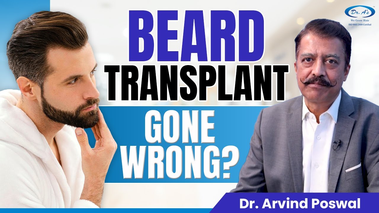 Beard Transplant Procedure Gone Wrong? Learn How to Correct? | Dr ...