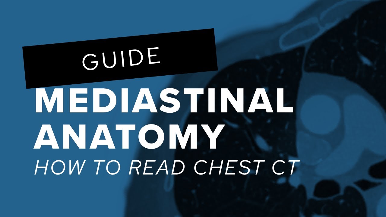 How to read chest CT: mediastinal anatomy - YouTube