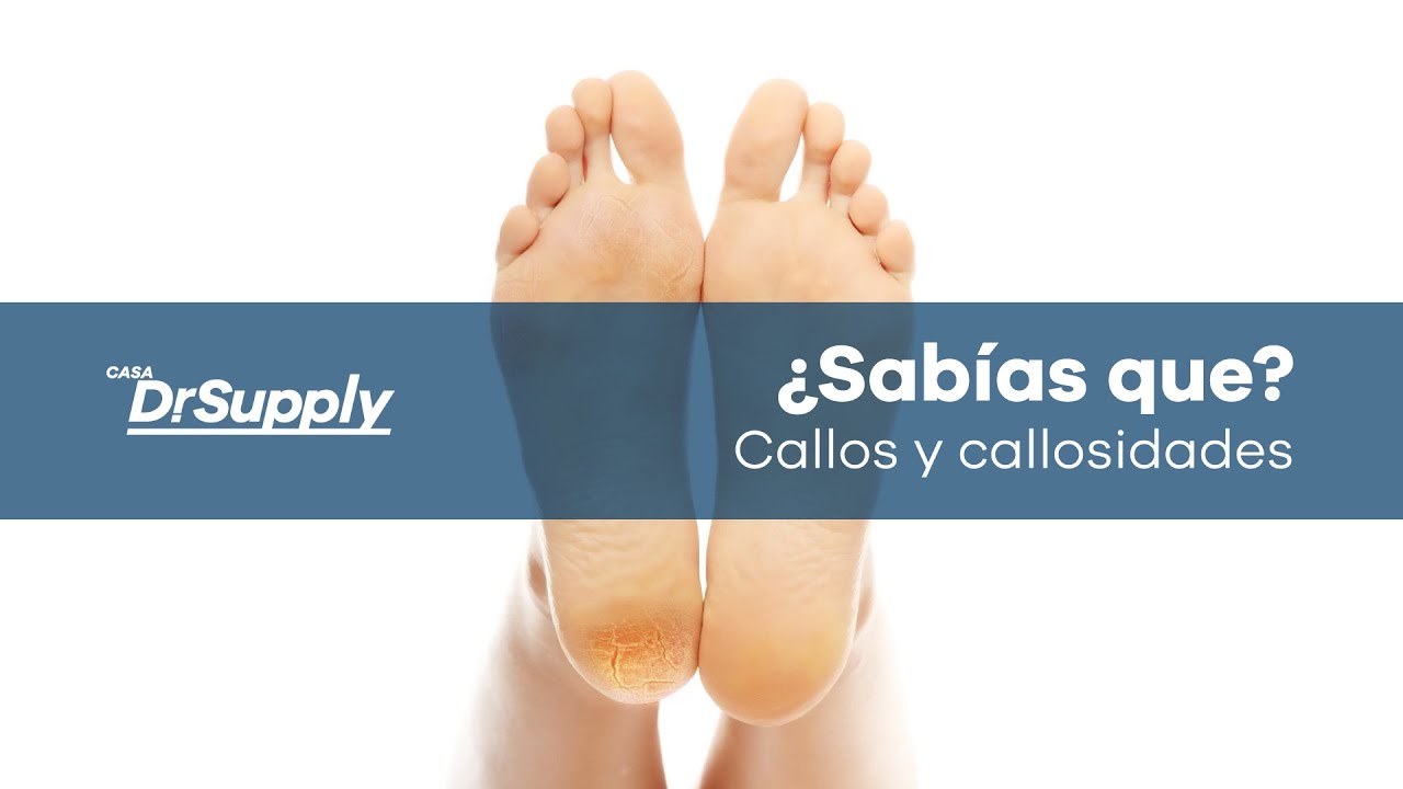 ¿Por qué se forman los callos? - YouTube
