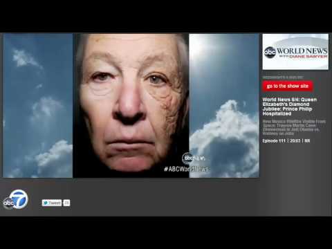Trucker's Face UV significantly sun damaged - YouTube