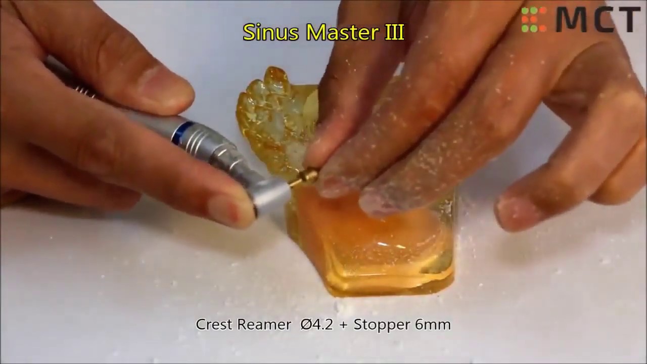 MCT Sinus Master Kit III - YouTube