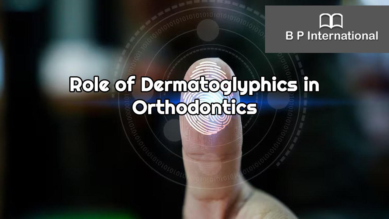 Role of Dermatoglyphics in Orthodontics - YouTube