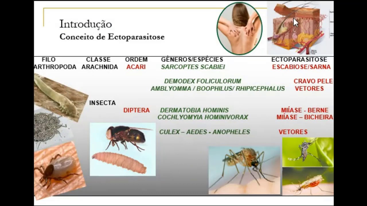 Ectoparasitos: Ordem Acari (escabiose) e Diptera (miíases) - YouTube