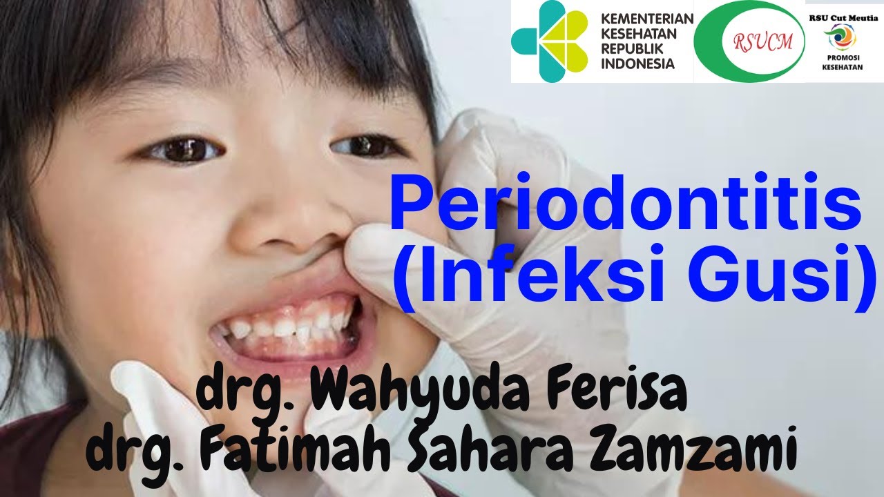 Periodontitis (Infeksi Gusi) - YouTube