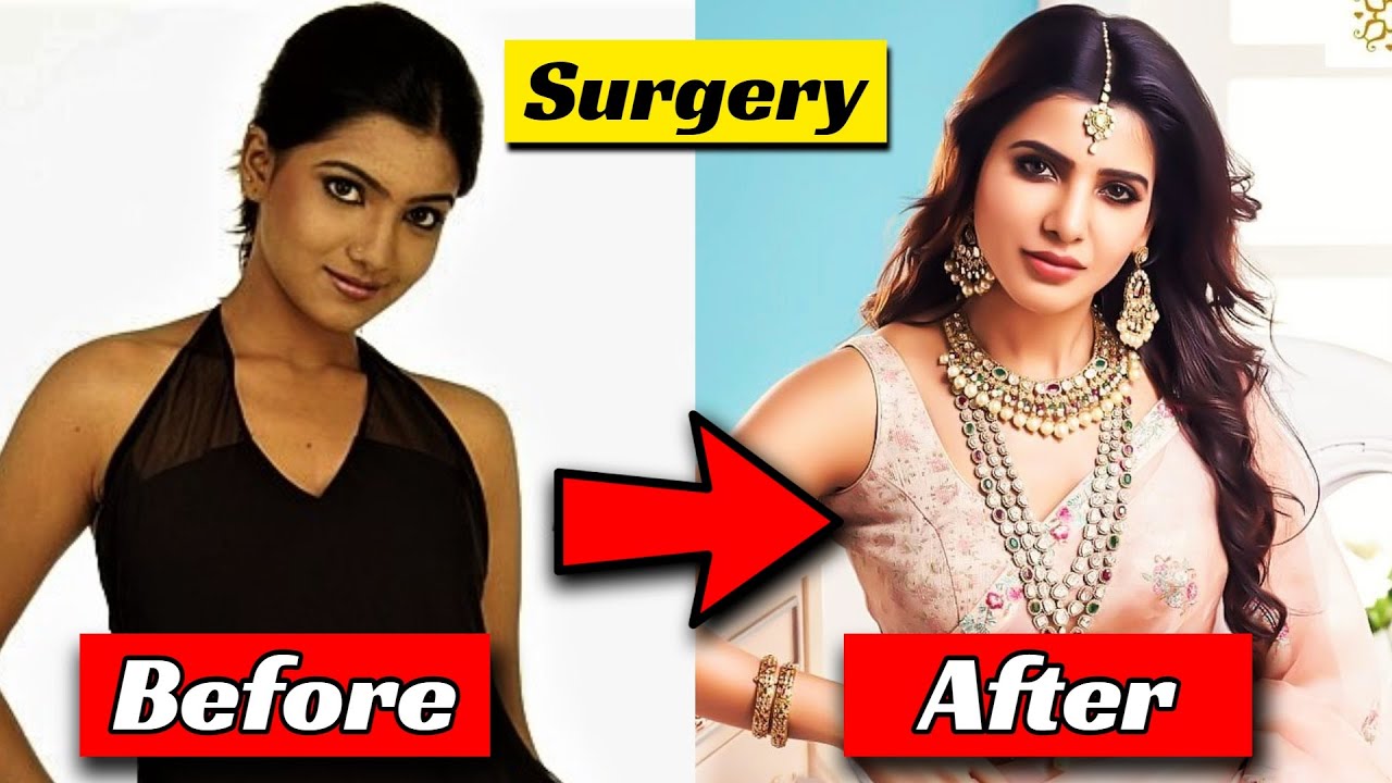 Plastic Surgery of South Indian Actresses Before And After 2022 - YouTube