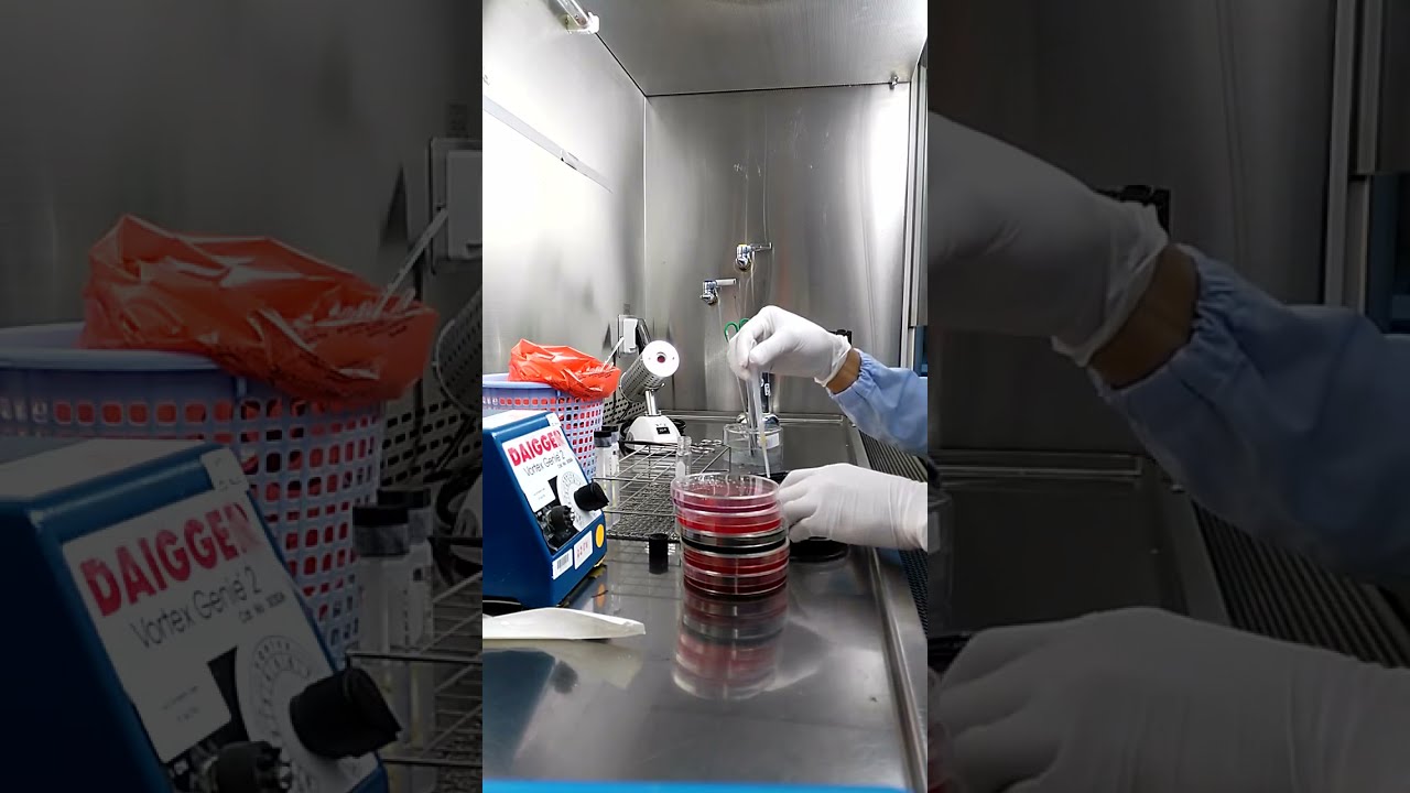 Stool Culture Processing - YouTube