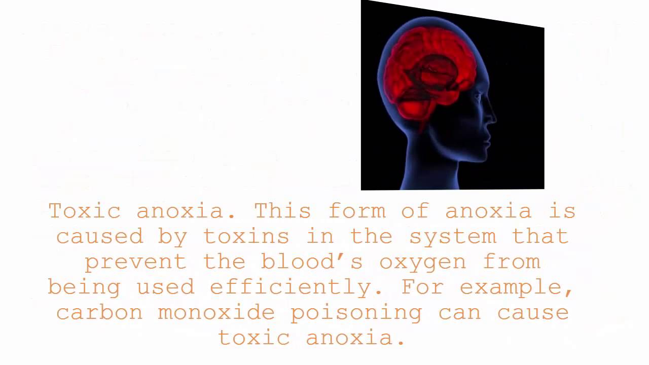 Anoxic Brain Injury - Good Life with The Process of Brain - YouTube