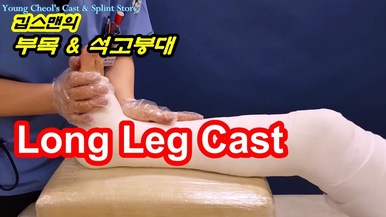 Long Leg Cast - YouTube