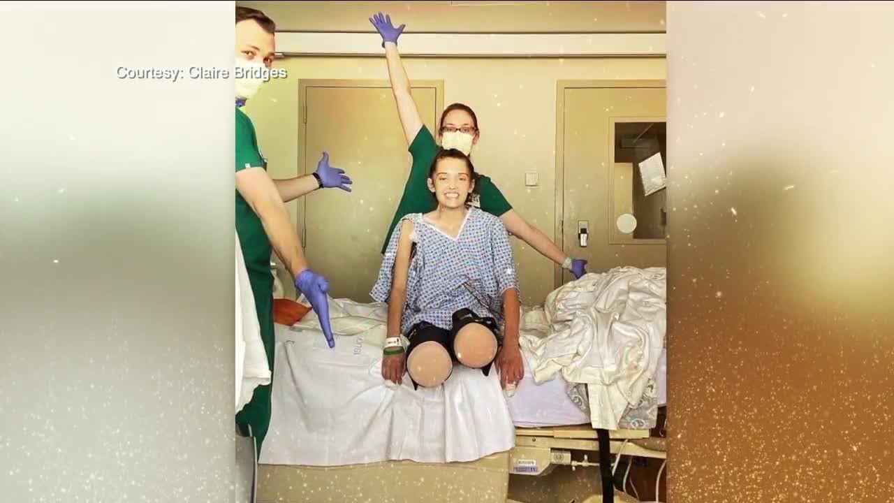 22-year-old who lost both legs after COVID complications recovers from ...