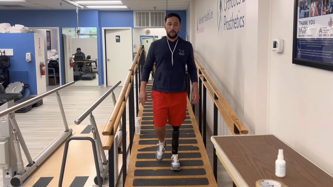 New Össur Navii Knee Prosthetic - 2 Day fitting at Medical Center ...