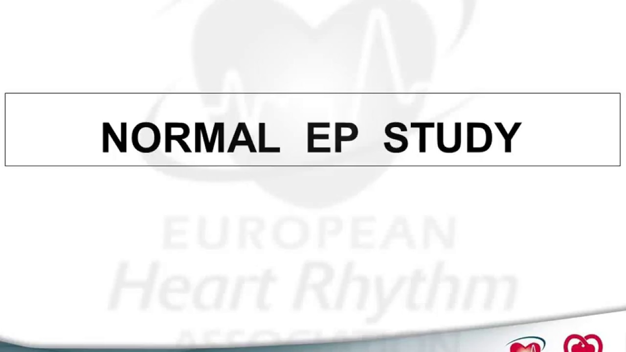 How to do a diagnostic EP study , step by step - YouTube