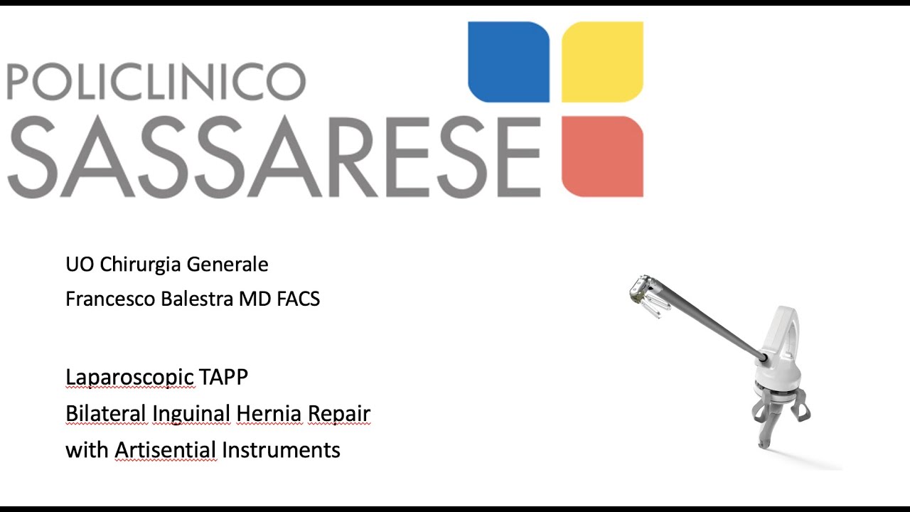 Bilateral Laparoscopic Inguinal Hernia repair TAPP with Artisential ...