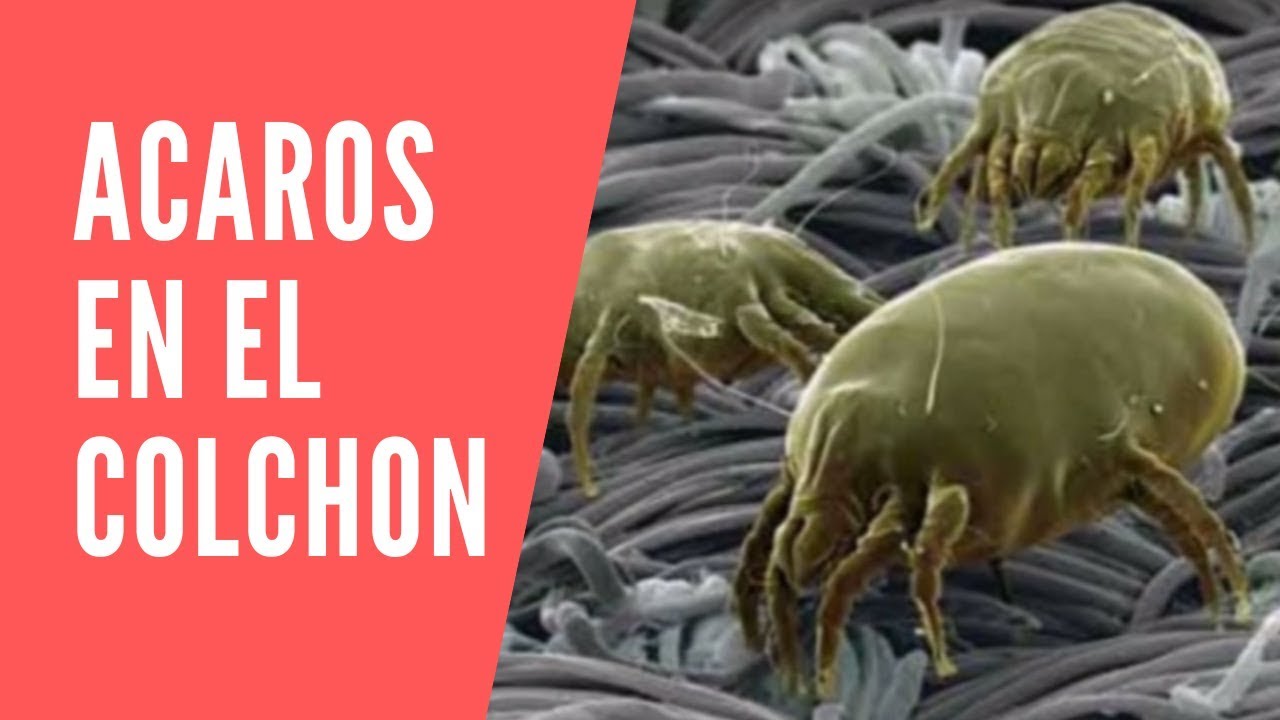 ACAROS: COMO ELIMINAR ACAROS DE TU CAMA - YouTube
