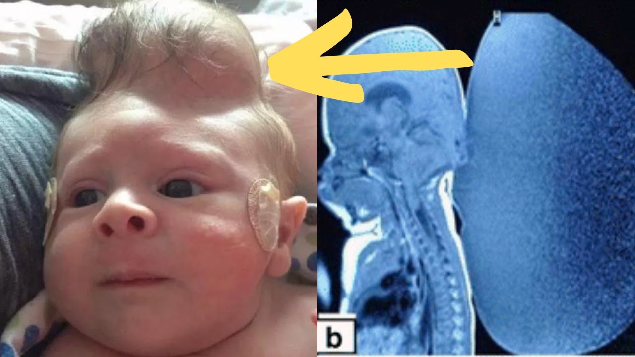 What Was Coming Out Of This Baby's Head Will Astounded You - YouTube