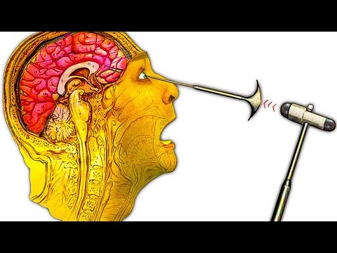 5 Жутких древних медицинских процедур