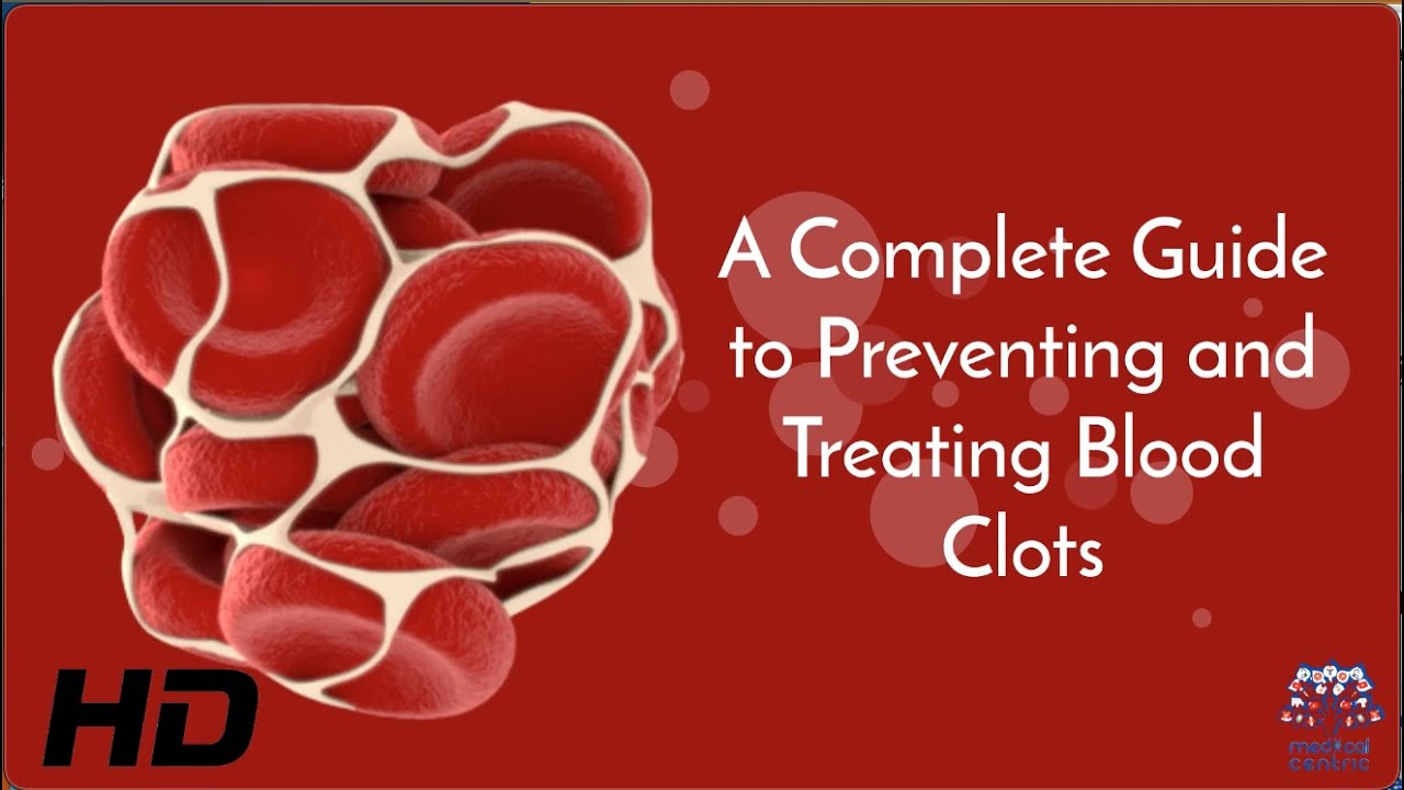 From Awareness to Action: Safeguarding Against Blood Clots - YouTube