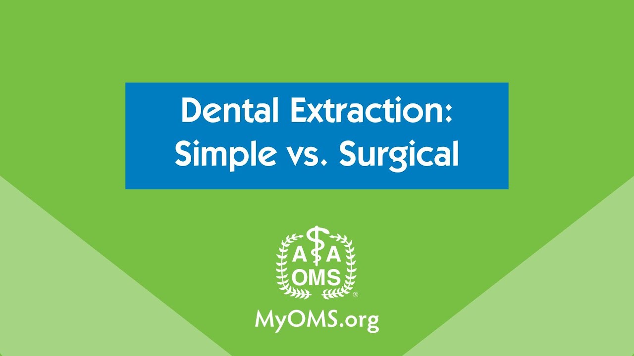 Dental Extraction: Simple vs. Surgical - YouTube